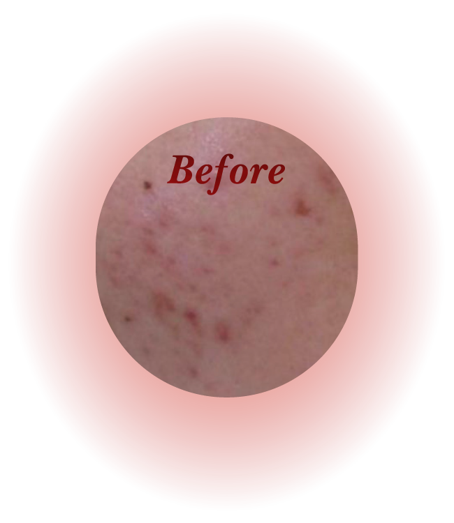 b-a20220501 | ROJEN®