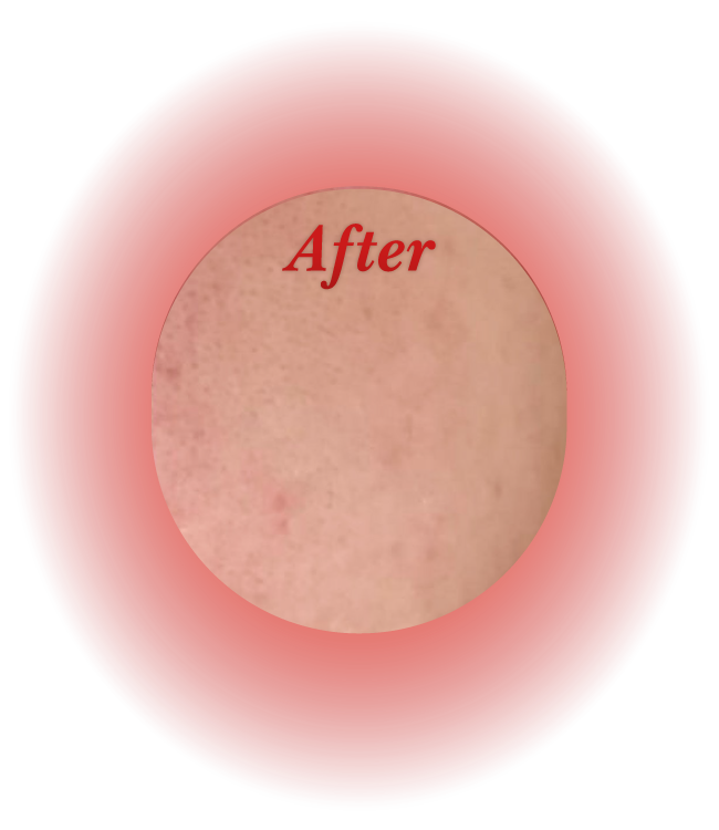 b-a20220502 | ROJEN®