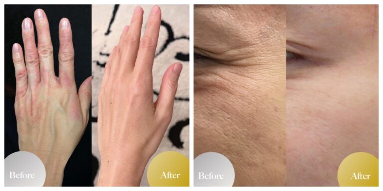 collage_2025102502 | ROJEN®